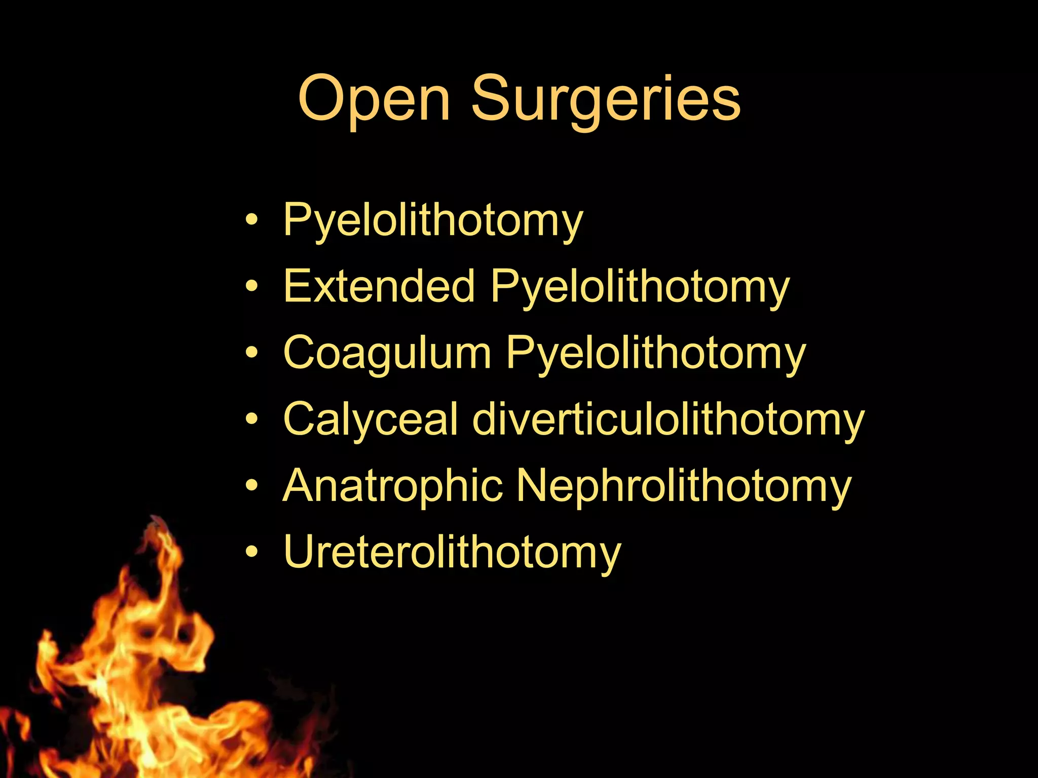 Urolithiasis evaluation and management brief | PDF