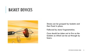 Urolithiasis management- icl. | PDF