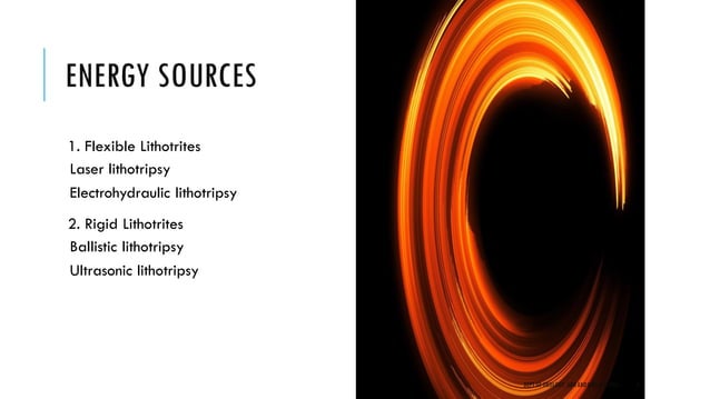 Urolithiasis management- icl. | PPT