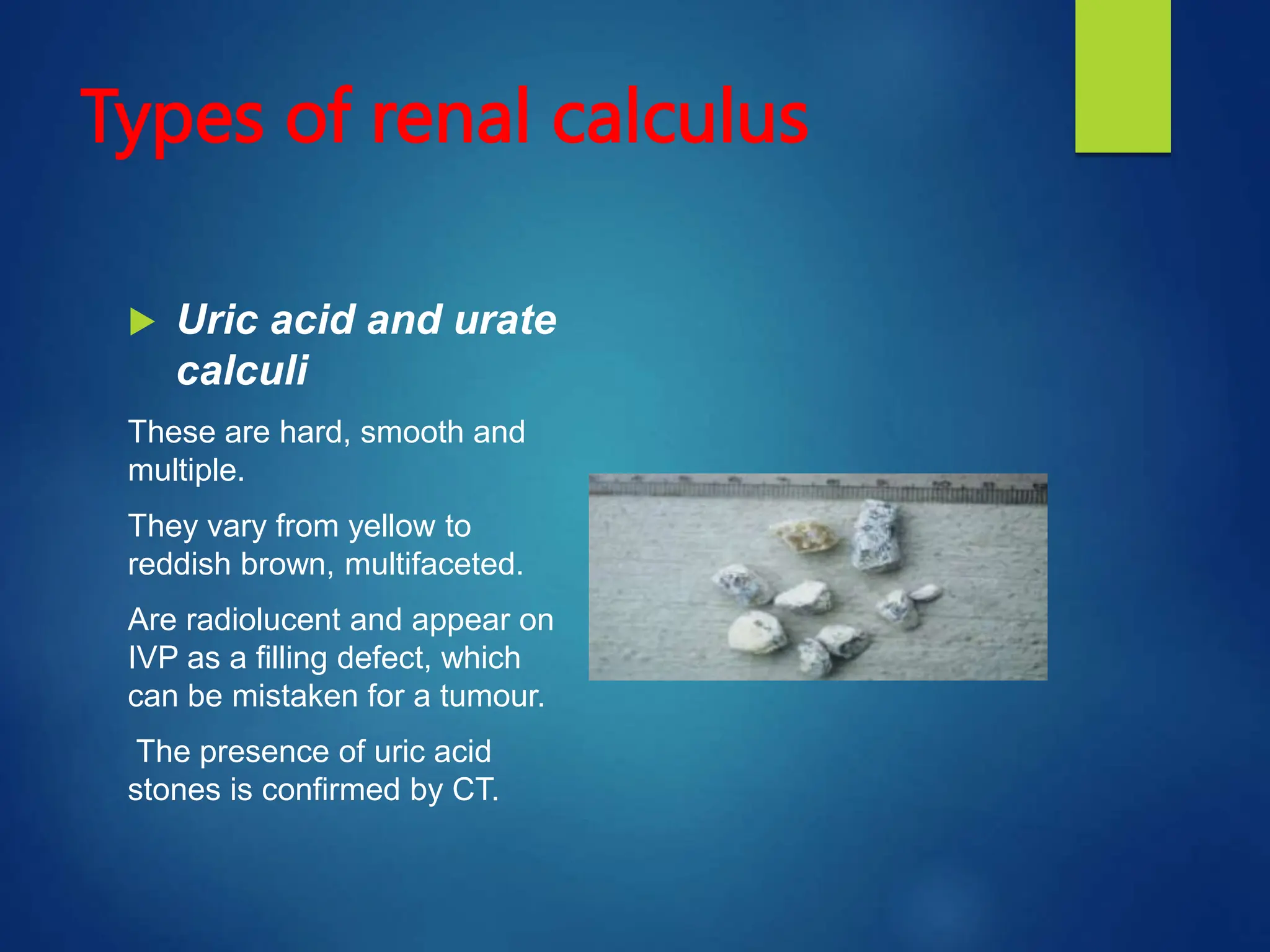 urolithiasis 2 by Dr Ahmed Sajjad HIT Taxila | PPTX | Digestive ...