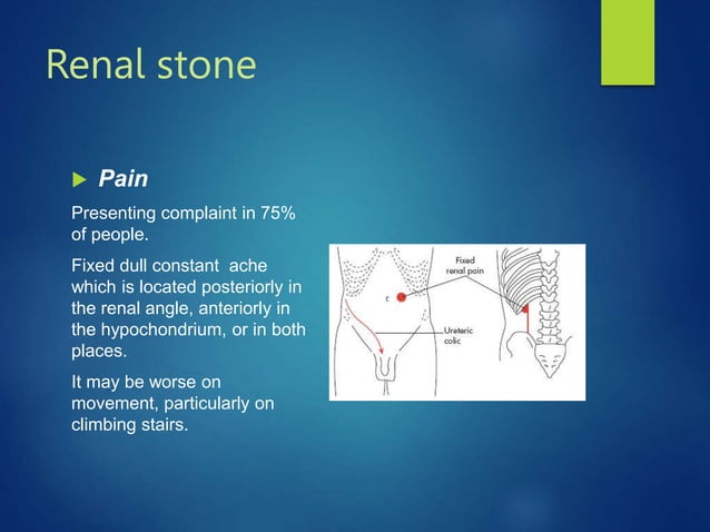 urolithiasis 2 by Dr Ahmed Sajjad HIT Taxila | PPT