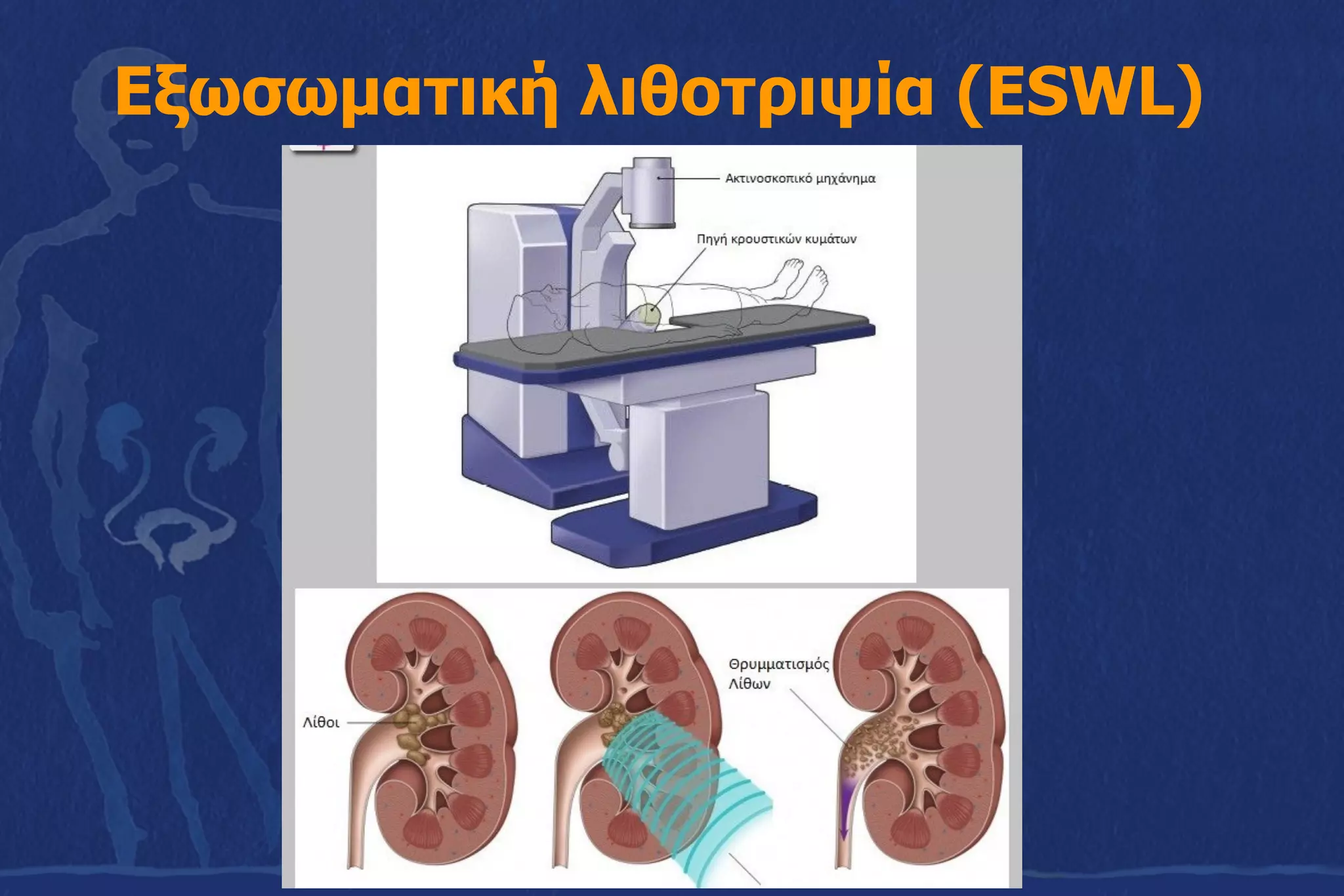 Urolithiasis 2019 | PPT