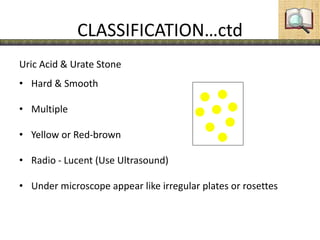 Urolithiasis (kidney stones) | PPTX