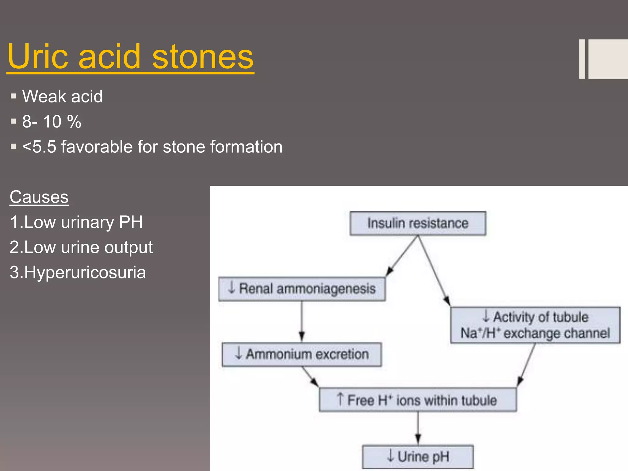 Urolithiasis pathophysiology , medical management | PPTX