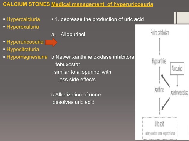 Urolithiasis pathophysiology , medical management | PPTX