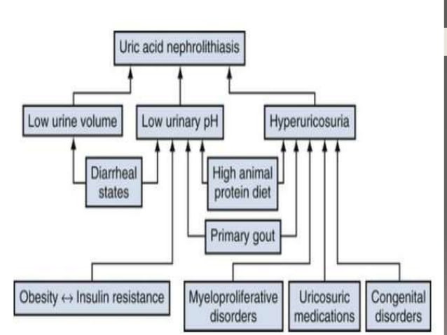 Urolithiasis pathophysiology , medical management | PPTX