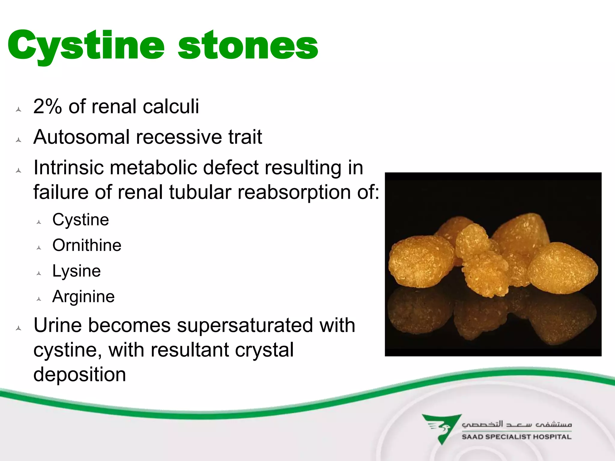 Urolithiasis (urinary stones disease) presentation | PPTX