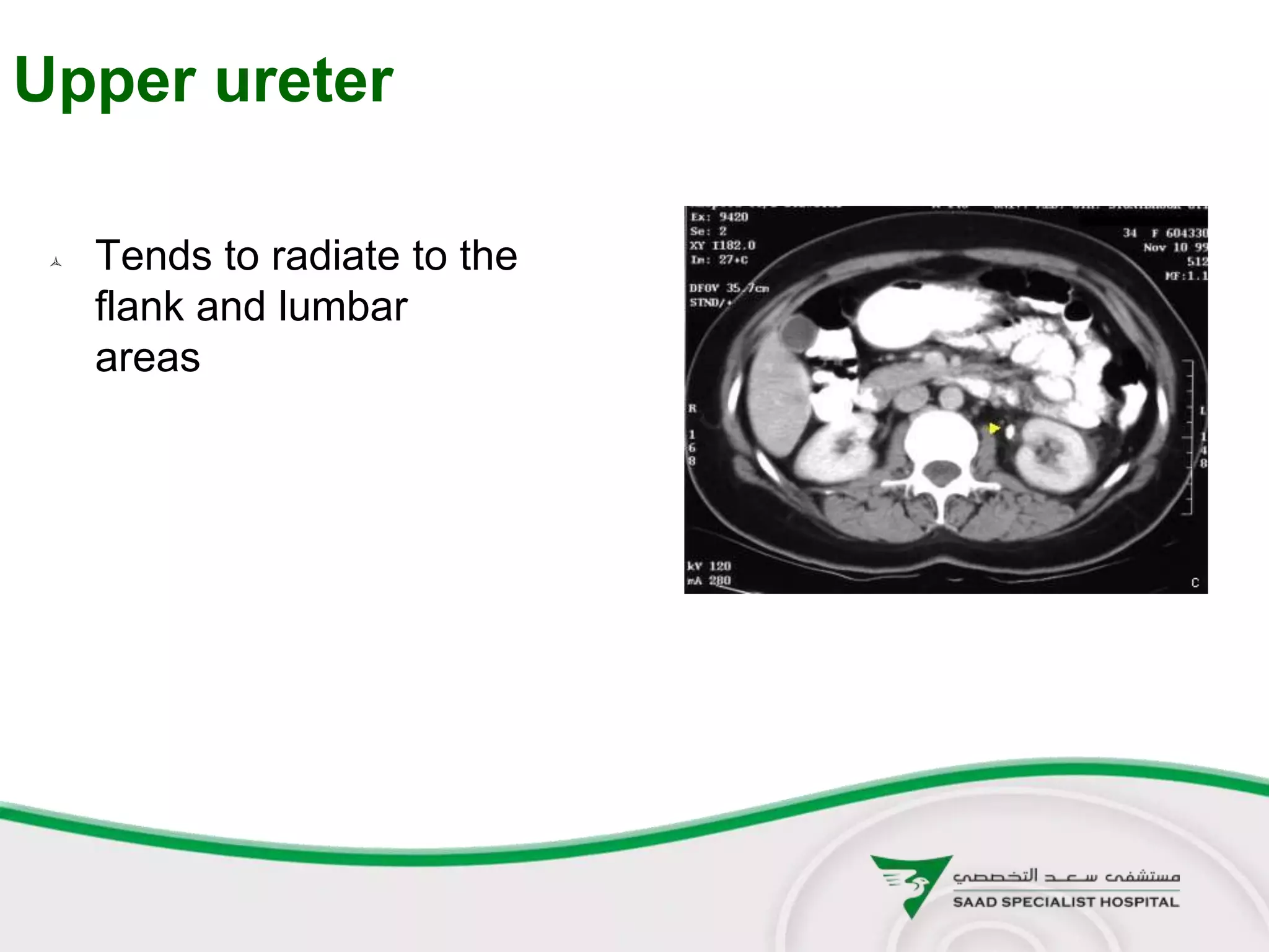 Urolithiasis (urinary stones disease) presentation | PPTX