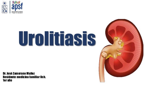 Urolitiasis- enfoque desde atención primaria