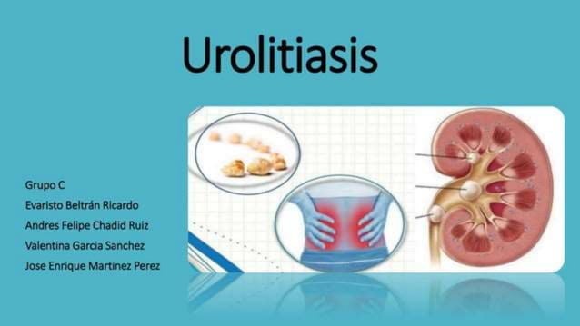 Urolitiasis - 20wdfvwefv240524_101505.pptx