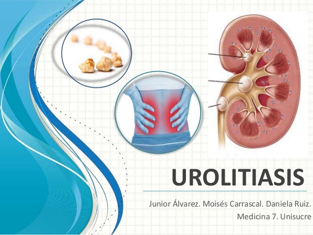 Urolitiasis
