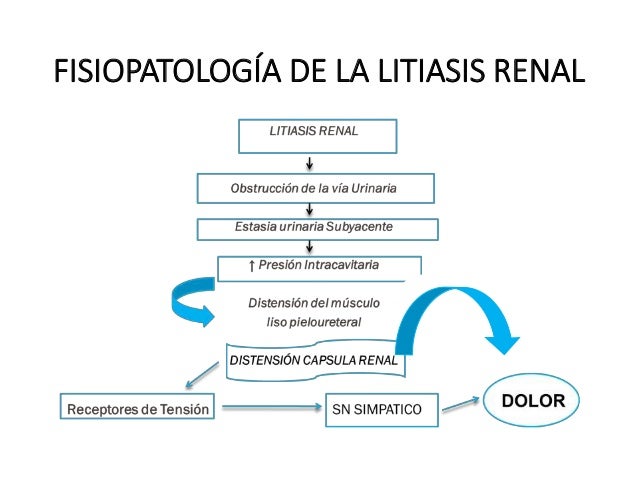 Urolitiasis