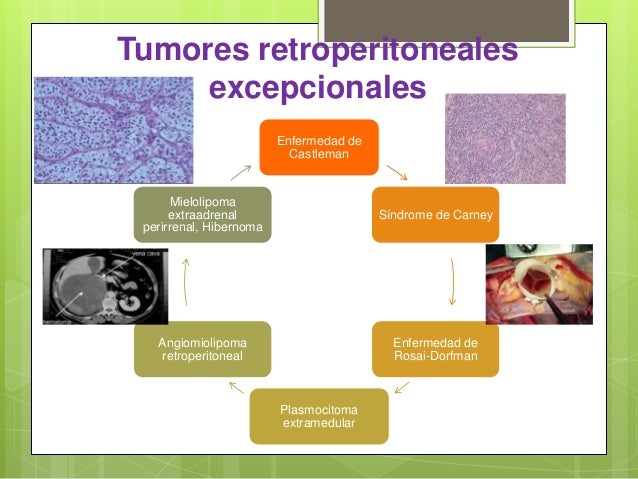 PATOLOGÍAS RETROPERITONEALES. A.V.