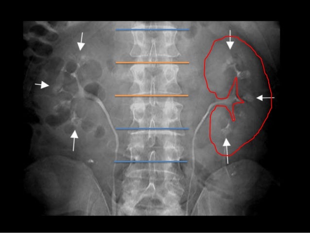 Imagenología de Vias Urinarias