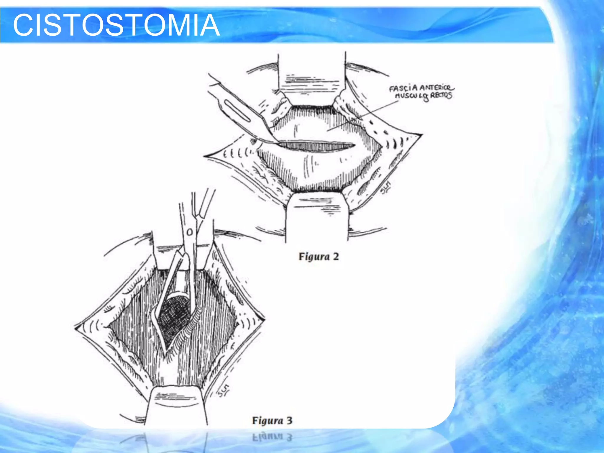 Urologia jonathan molina