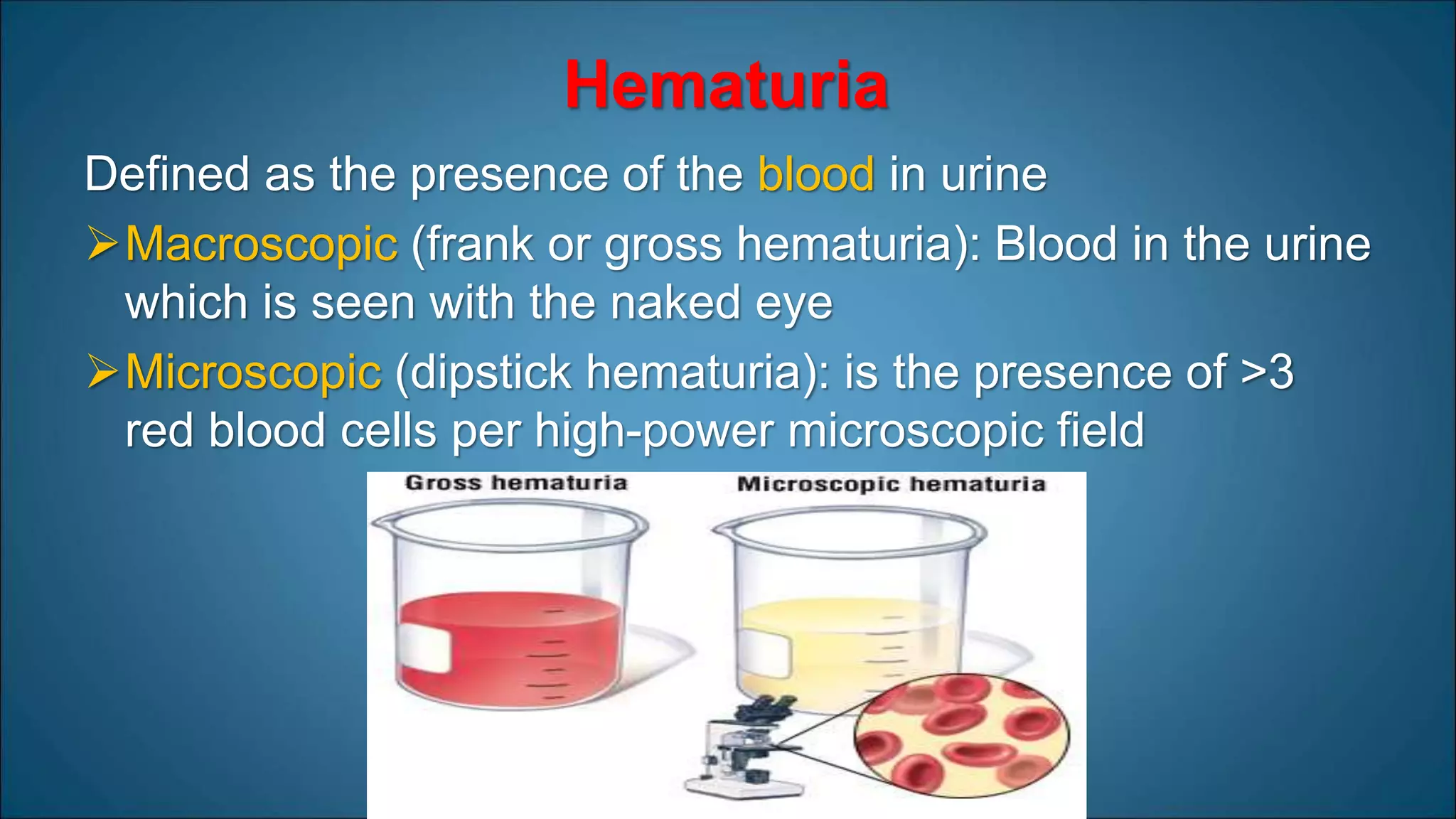 Urological emergency | PPTX