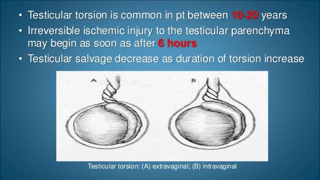 Urological emergency