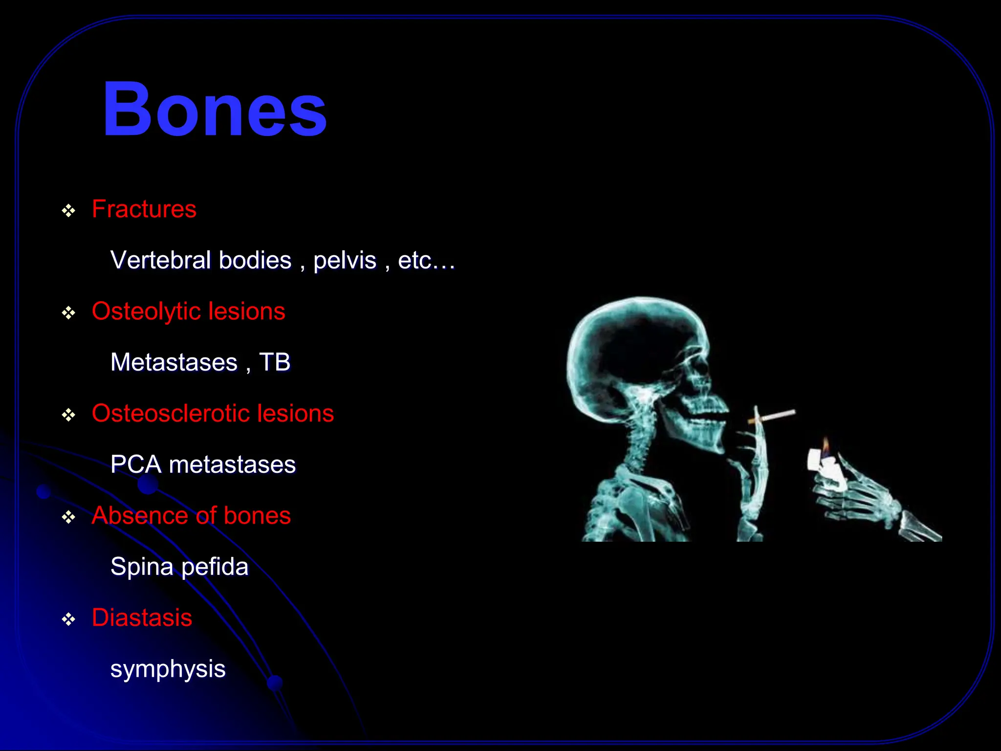 basics of Urological imaging focusig on kub.ppt