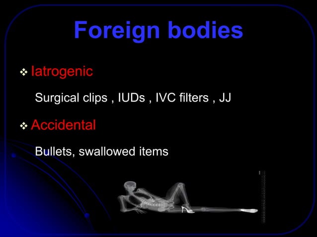 basics of Urological imaging focusig on kub.ppt