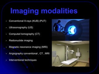 basics of Urological imaging focusig on kub.ppt