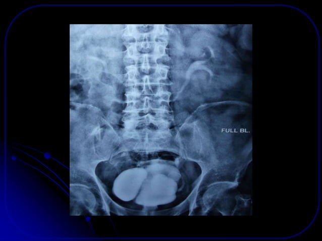 basics of Urological imaging focusig on kub.ppt