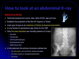 basics of Urological imaging focusig on kub.ppt