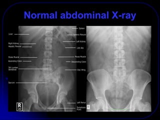 basics of Urological imaging focusig on kub.ppt