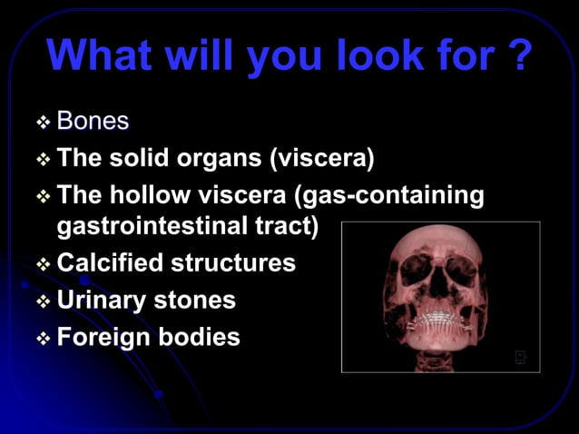 basics of Urological imaging focusig on kub.ppt
