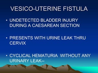 Urological injuries | PPTX