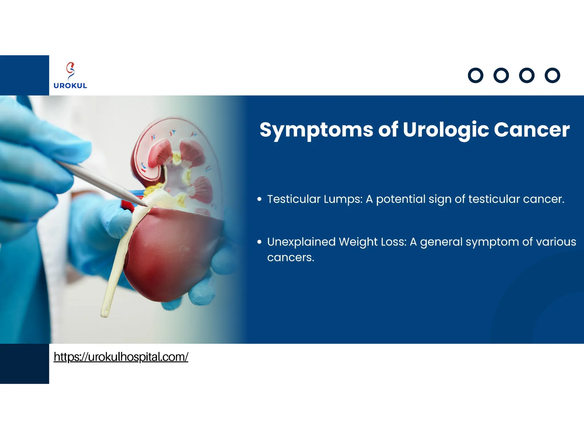 Urologic Cancer: Symptoms & Causes Urokul | PPT