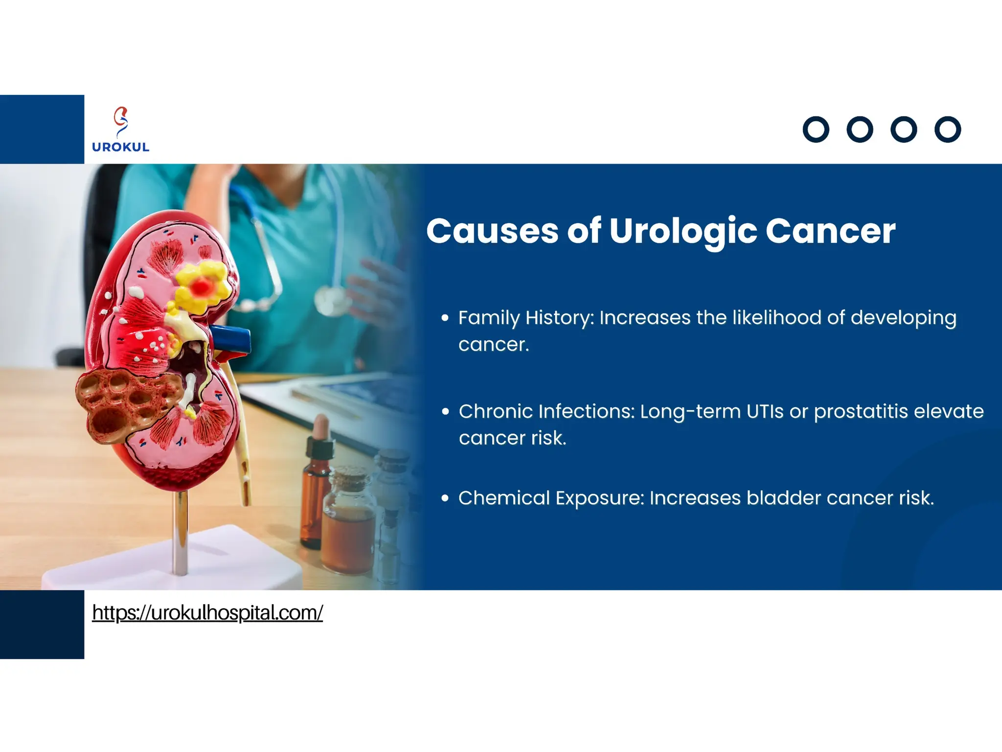 Urologic Cancer: Symptoms & Causes Urokul | PPT