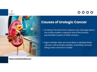 Urologic Cancer: Symptoms & Causes Urokul | PPT