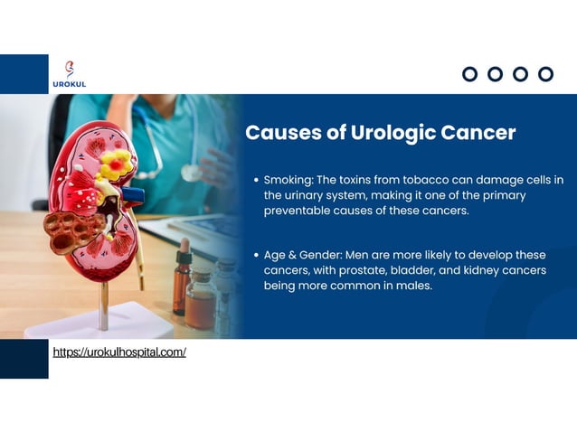 Urologic Cancer: Symptoms & Causes Urokul | PPT
