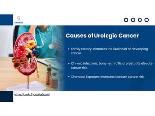 Urologic Cancer: Symptoms & Causes Urokul | PPT