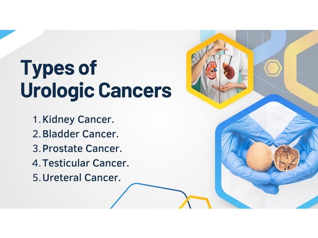 Urologic Cancer: Symptoms & Causes | PPTX
