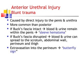 Urologic trauma | PPT