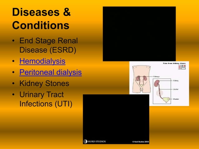 Urology | PPT