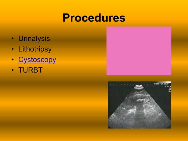 Urology | PPT