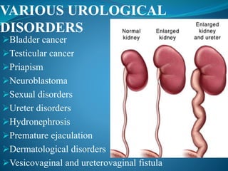 Austin Journal of Urology | PPT
