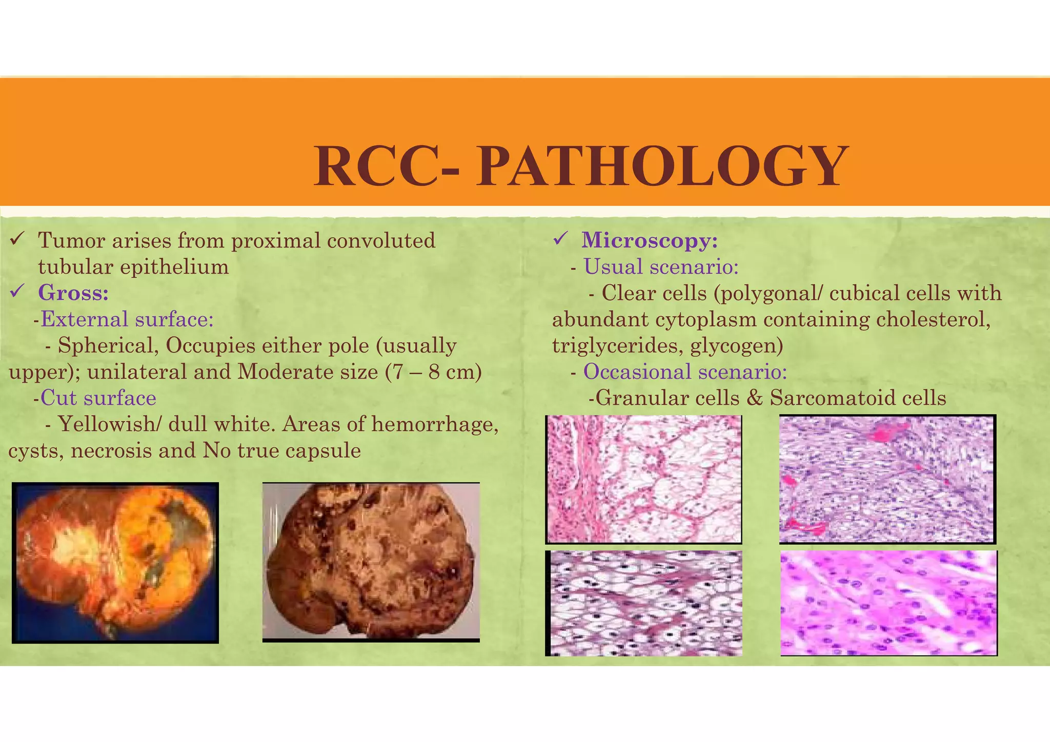Urology- Hematuria, Renal/Ureteric colic and Bladder Outlet Obstruction ...