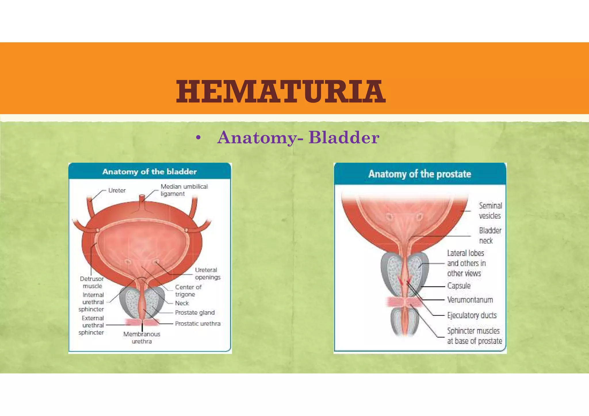 Urology- Hematuria, Renal/Ureteric colic and Bladder Outlet Obstruction ...