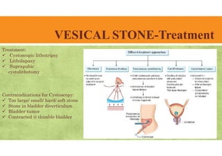 Urology- Hematuria, Renal/Ureteric colic and Bladder Outlet Obstruction ...