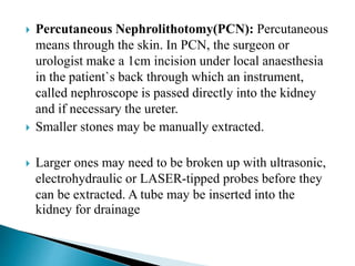 UROLOGY class presentation. Introduction | PPT