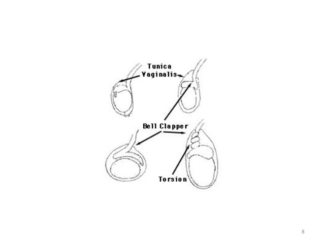 Urology 37 torsion_of_the_testis_or_of_the_spermatic