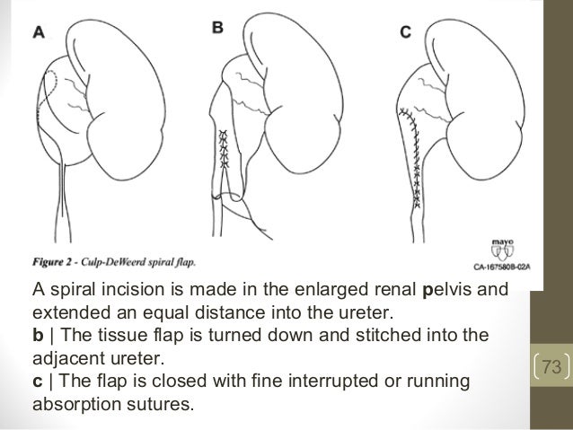 Urology 4 hydronephrosis