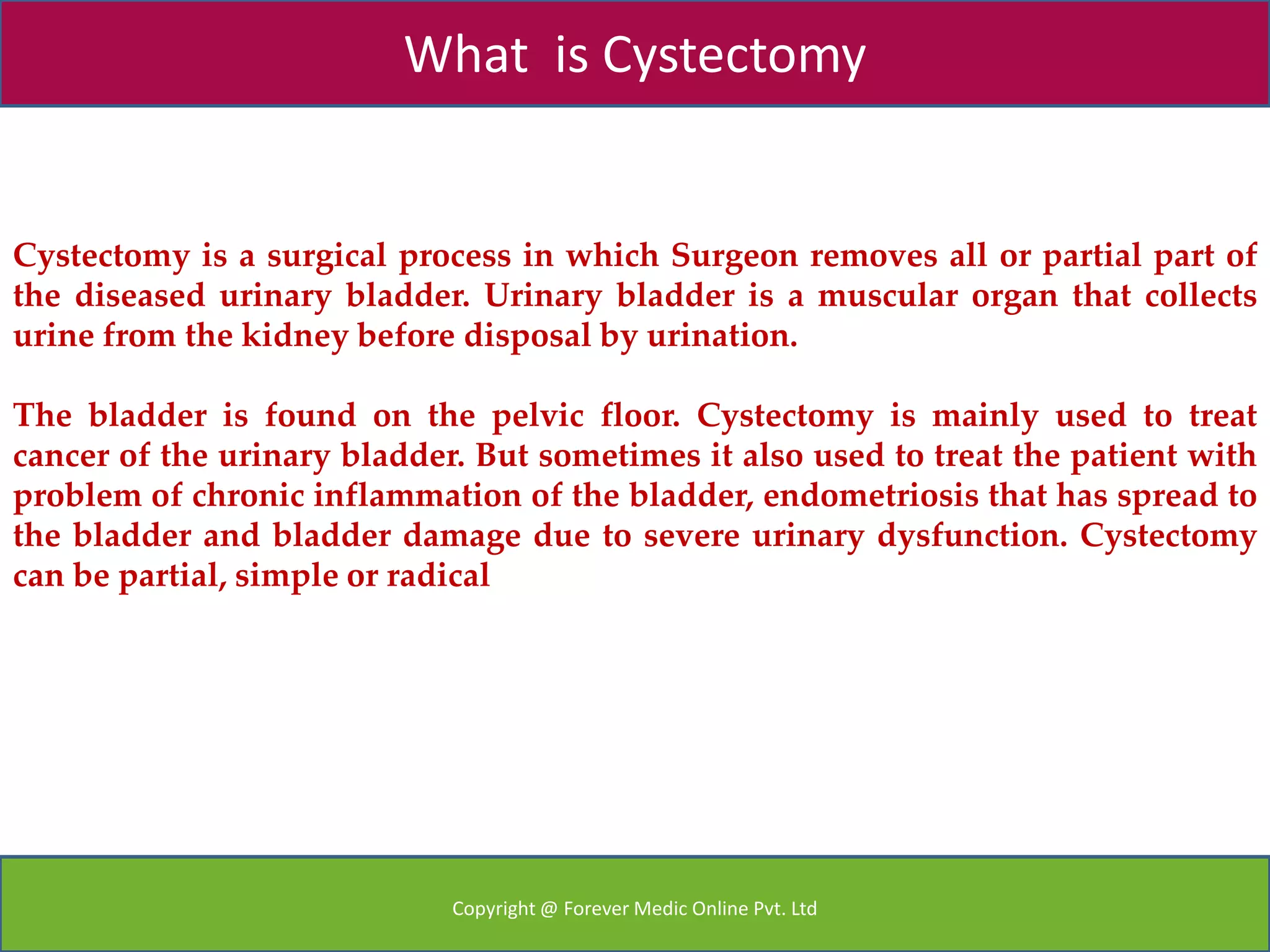 Urology ( cystectomy) | PPTX