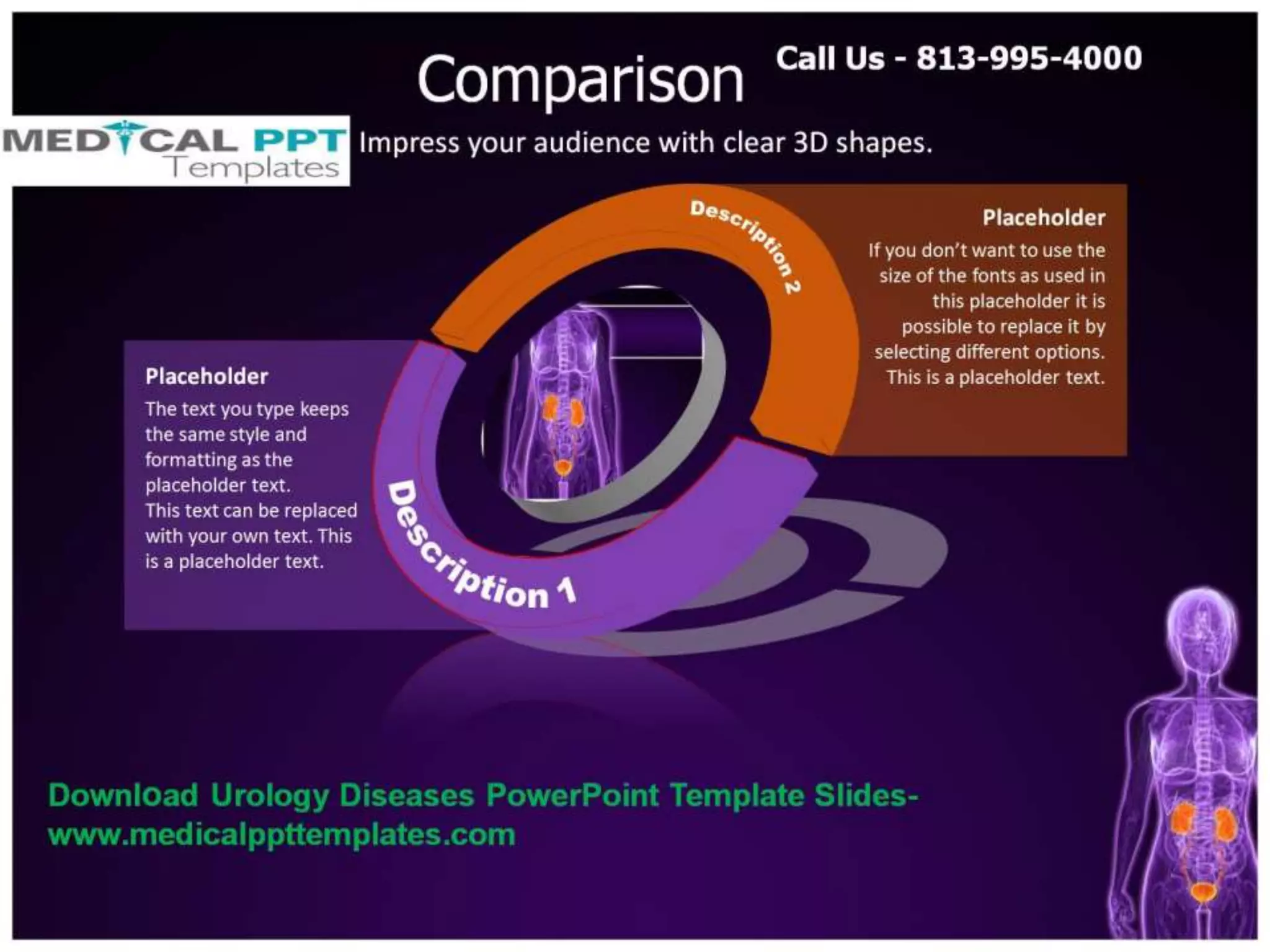 Urology Diseases PowerPoint Template Slides | PPTX