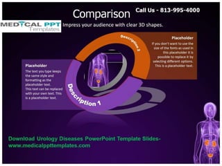 Urology Diseases PowerPoint Template Slides | PPTX
