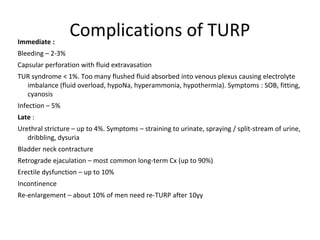 Urology finalized | PPT