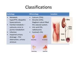 Urology finalized | PPT